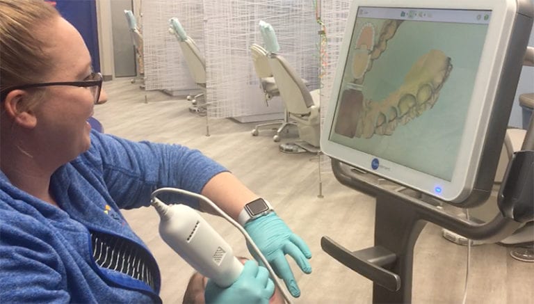 iTero Element intraoral scanner in Frisco, TX | RxSmile Frisco ...